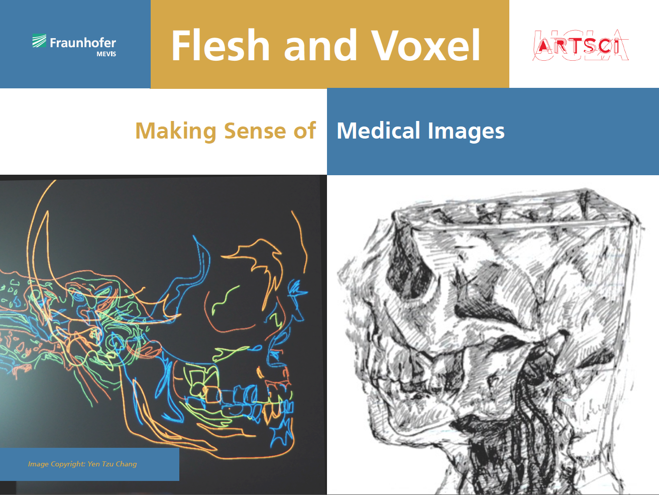 Flesh and Voxel: Making Sense of Medical Images | STEM TO STEAM | UCLA ...